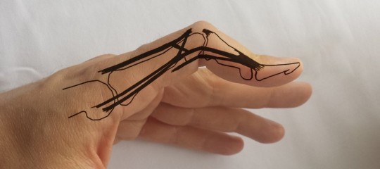 Deget in resort sau deget care se blocheaza - Dr. Vladislav Gyebnar